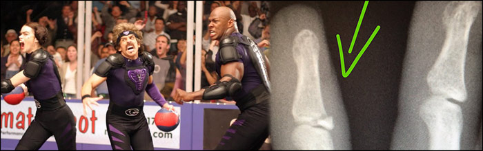Smash Bros. god may miss fourth biggest Melee tournament of all time ...